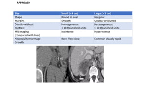 Radiological Imaging of the adrenal masses | PPTX