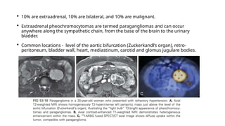 Radiological Imaging of the adrenal masses | PPTX