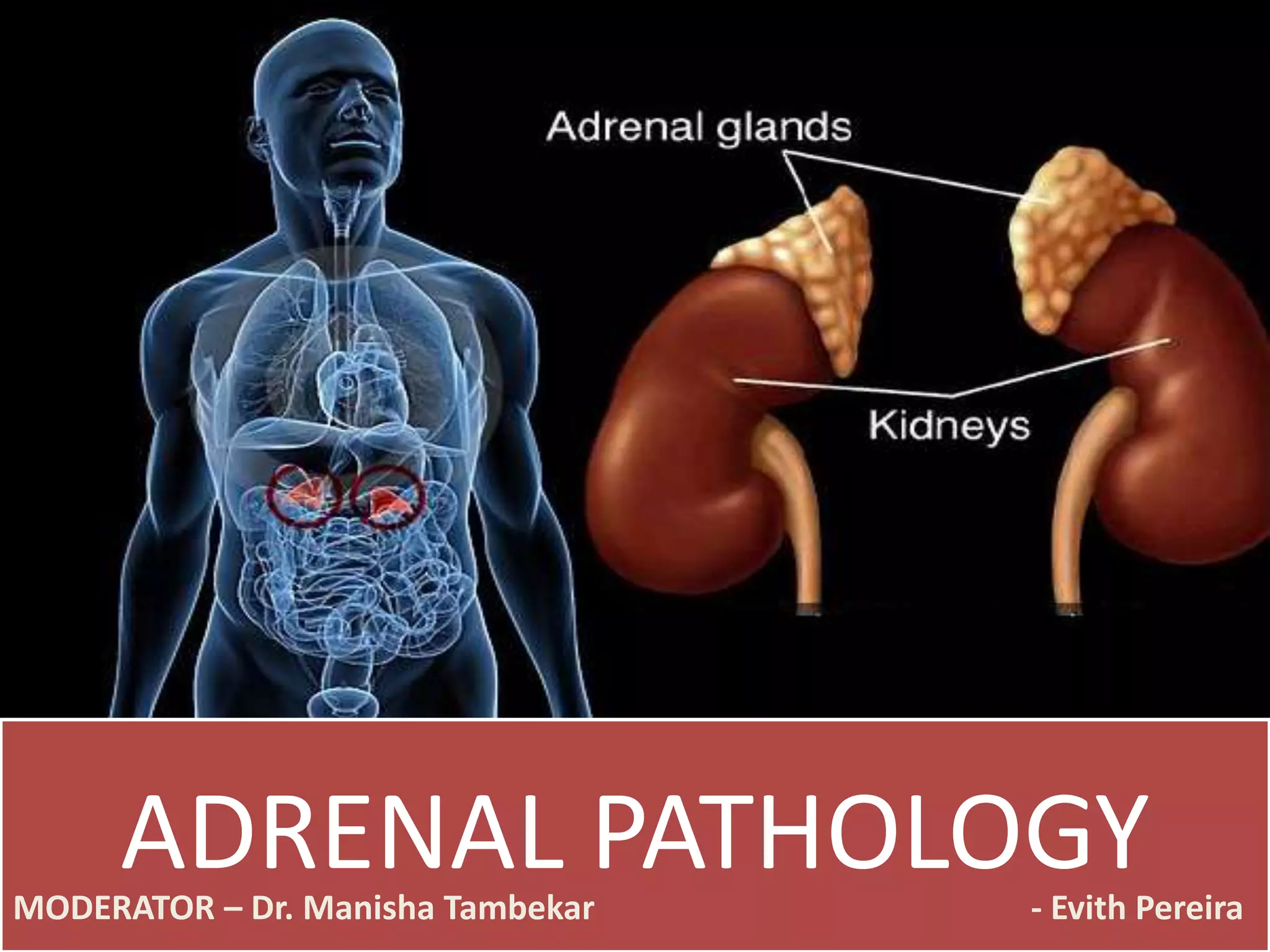 Adrenal Pathology | PPTX