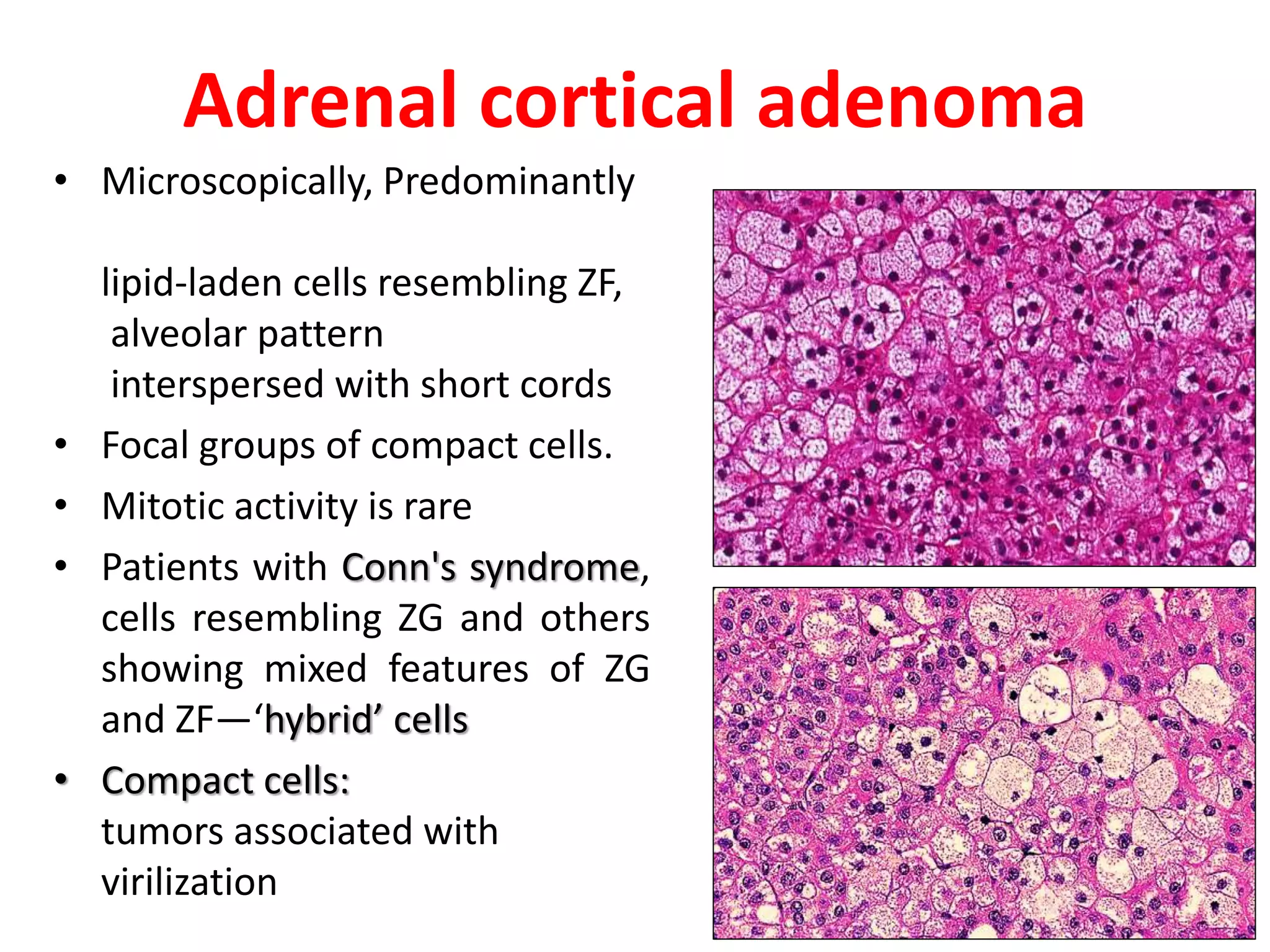 Adrenal Pathology | PPTX