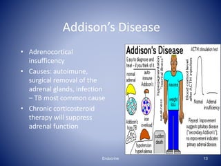 Adrenals and Addison's Disease 2016 rev pp.pptx