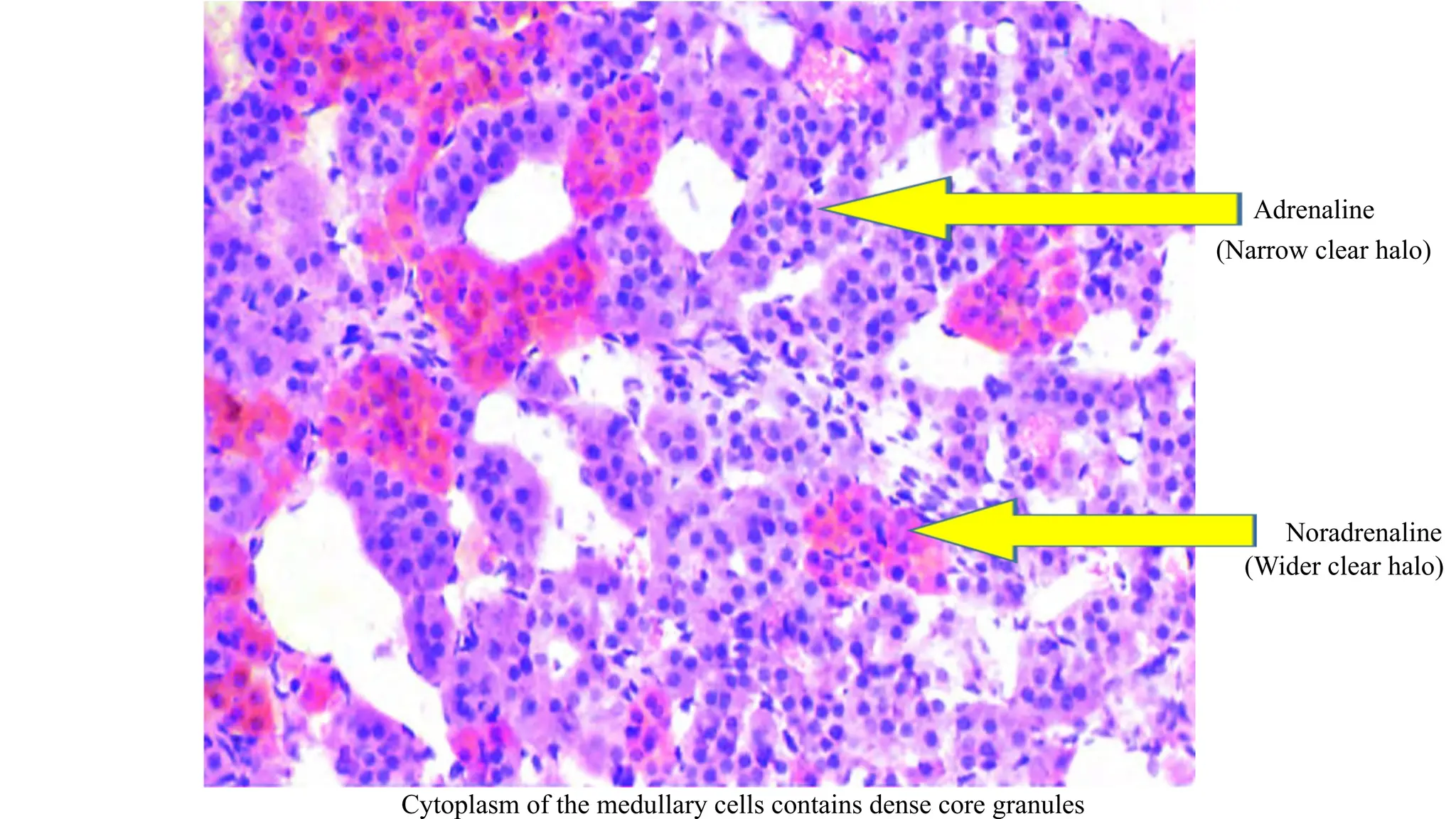 adrenal cortex and medulla benign and malignant tumors.pptx