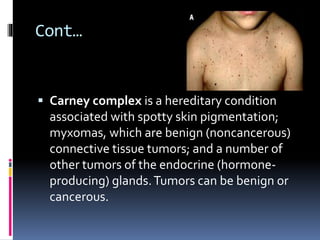 Adrenal tumour | PPTX