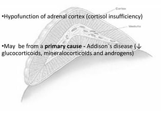 Adrenocortical insufficiency | PPT