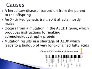 Adrenoleukodystrophy | PPTX