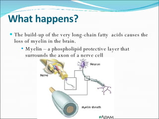 Student Work ALD | PPT