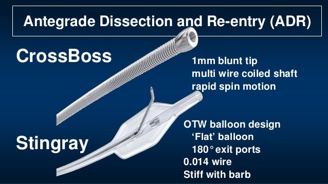 Where is the role for Antegrade dissection reentry?