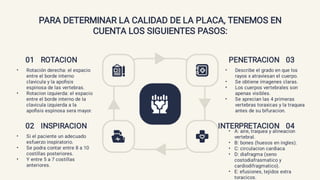 Lectura de rx torax en una radiografia normal | PDF