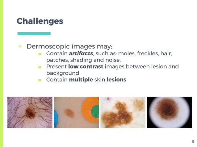 Skin Lesion Detection From Dermoscopic Images Using Convolutional