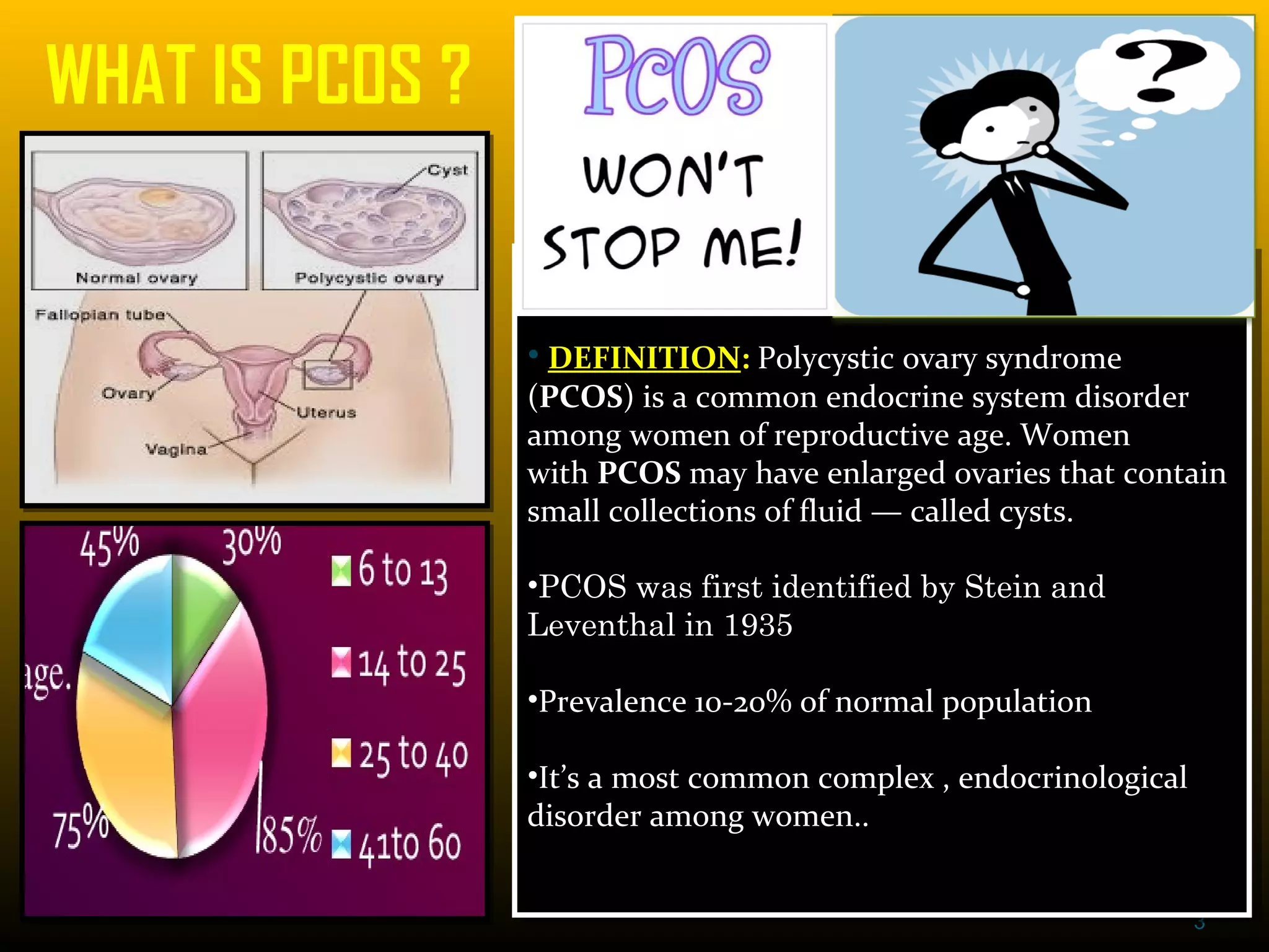 polycystic ovarian syndrome | PPT