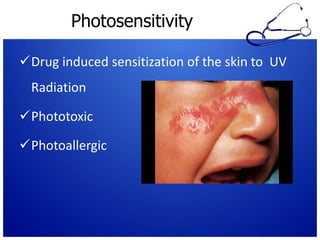 Adverse Drug Reaction | PPTX