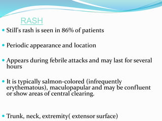 Adult onset-still-disease-1 | PPTX