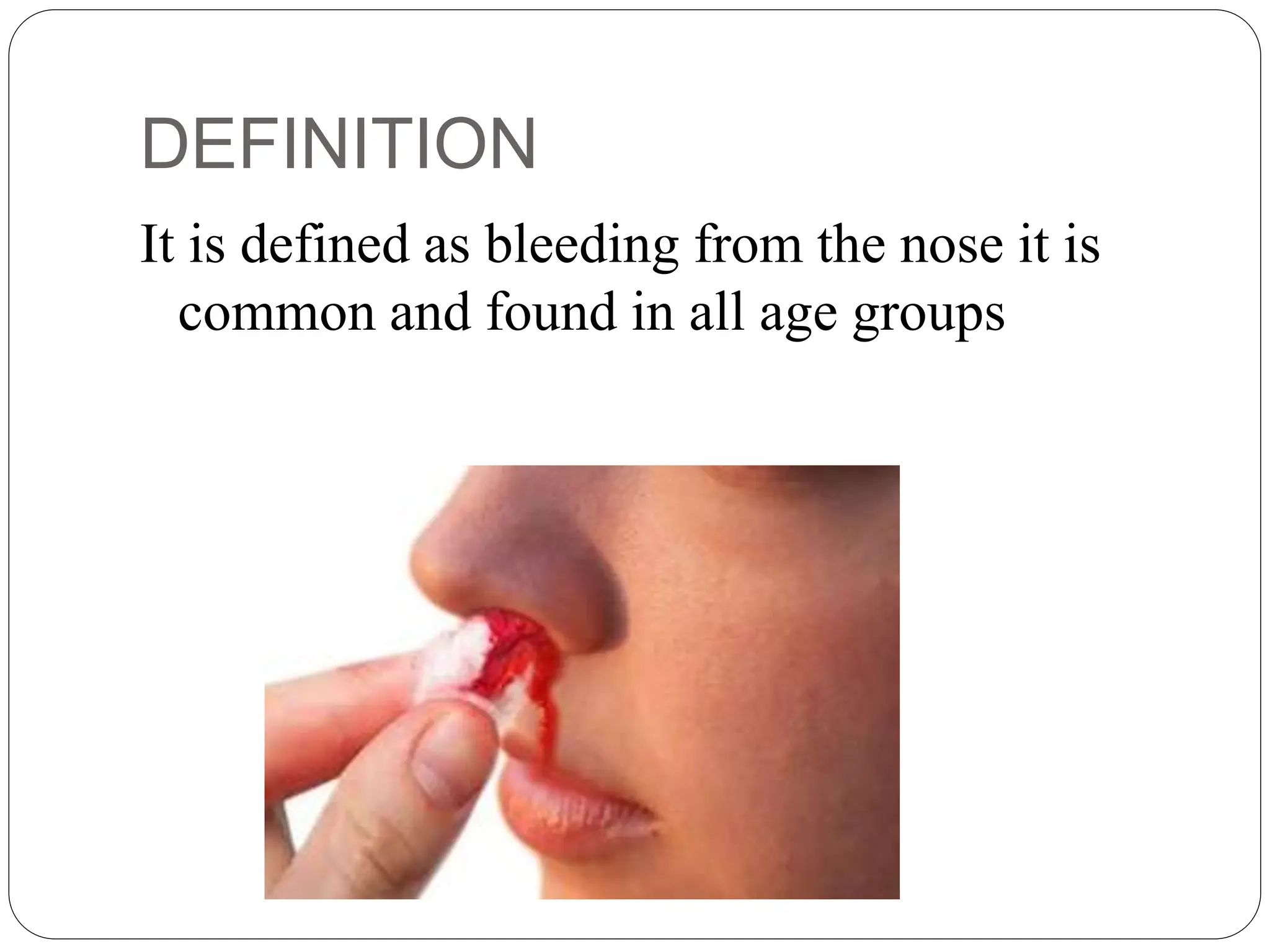 Adult epistaxis Etiology and management .pptx