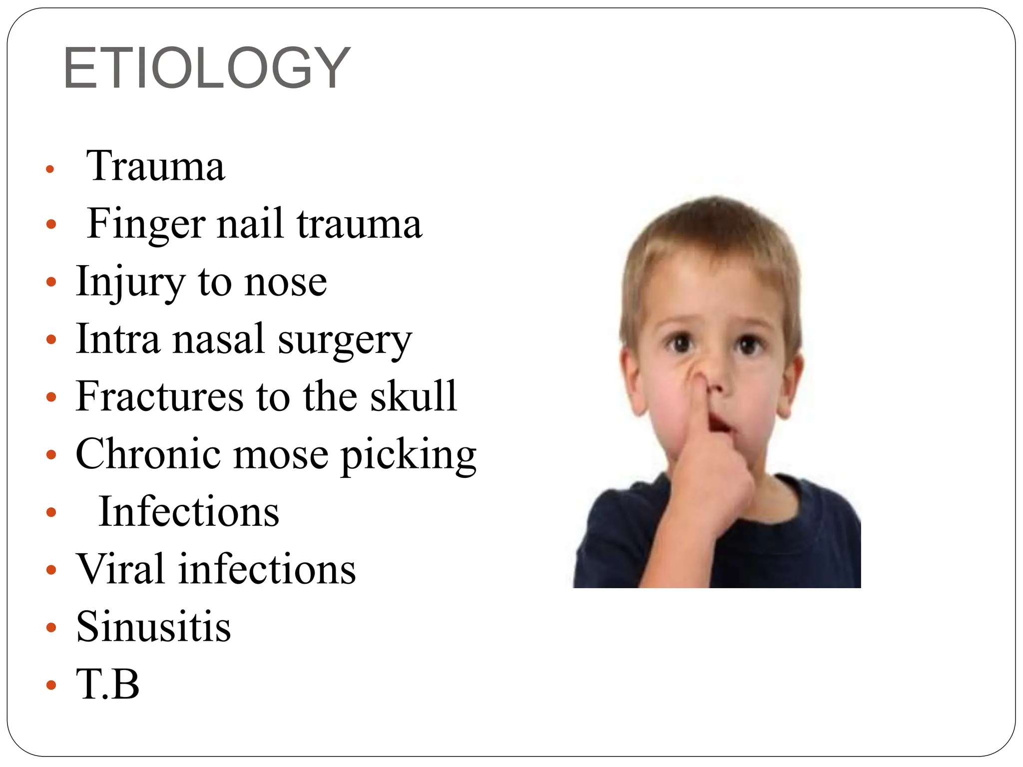 Adult epistaxis Etiology and management .pptx