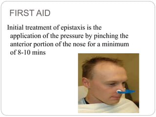Adult epistaxis Etiology and management .pptx