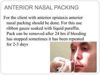 Adult epistaxis Etiology and management .pptx