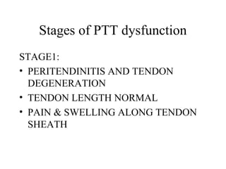 Adult aquired flatfoot | PPT