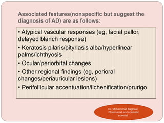 Adult atopic dermatitis by : Dr. Mohammad Baghaei | PPT