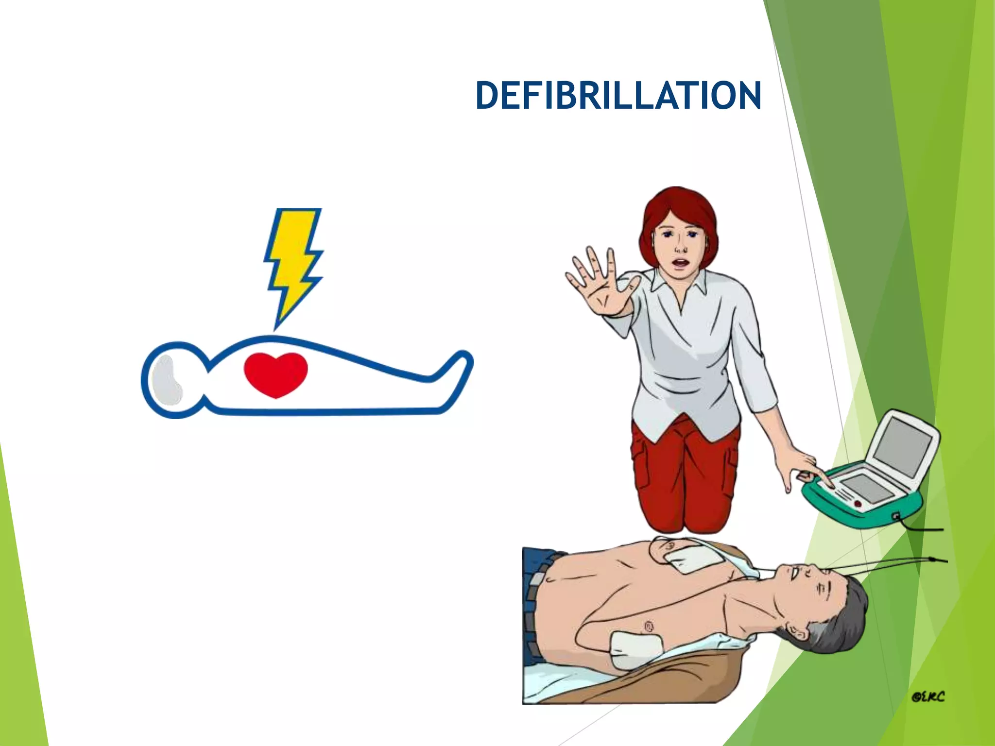 BASIC LIFE SUPPORT (ADULT) BLS | PPT
