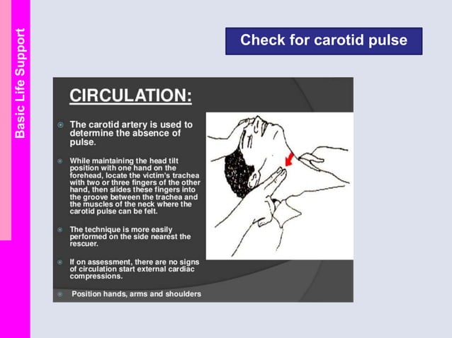 Cardiopulmonary resuscitation ( BLS ) Slide share | PPT