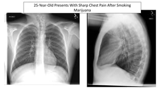 Drs. Milam and Thomas's CMC X-Ray Mastery Project: January Cases | PPT