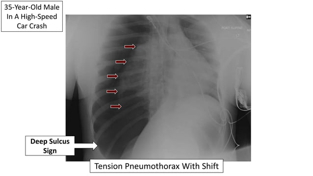Drs. Milam and Thomas's CMC X-Ray Mastery Project: January Cases