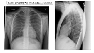 Drs. Milam and Thomas's CMC X-Ray Mastery Project: January Cases | PPT
