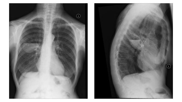 Drs. Milam and Thomas's CMC X-Ray Mastery Project: January Cases