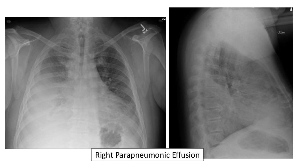 Drs. Milam and Thomas's CMC X-Ray Mastery Project: March Cases