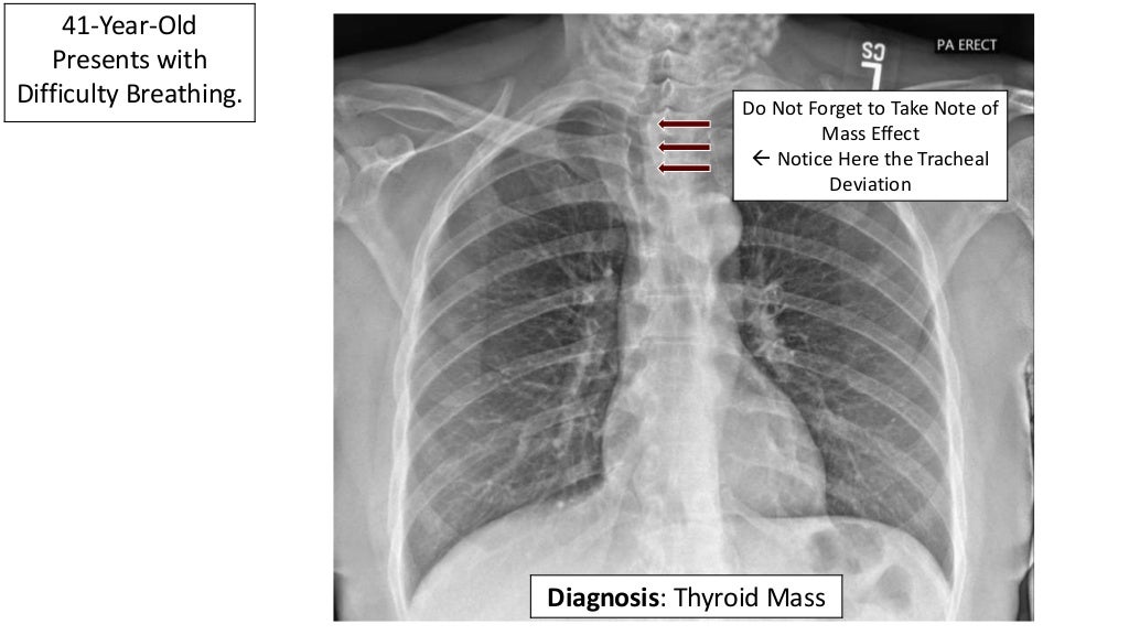Drs. Milam and Thomas's CMC X-Ray Mastery Project: March Cases