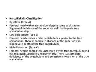 Adult hip dysplasia | PPTX