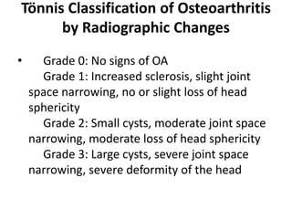 Adult hip dysplasia | PPTX