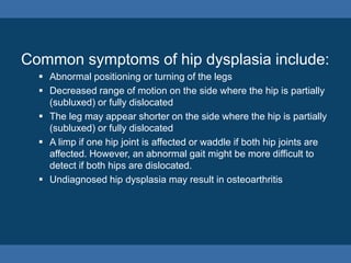 Adult Hip Dysplasia Presentation | PPTX