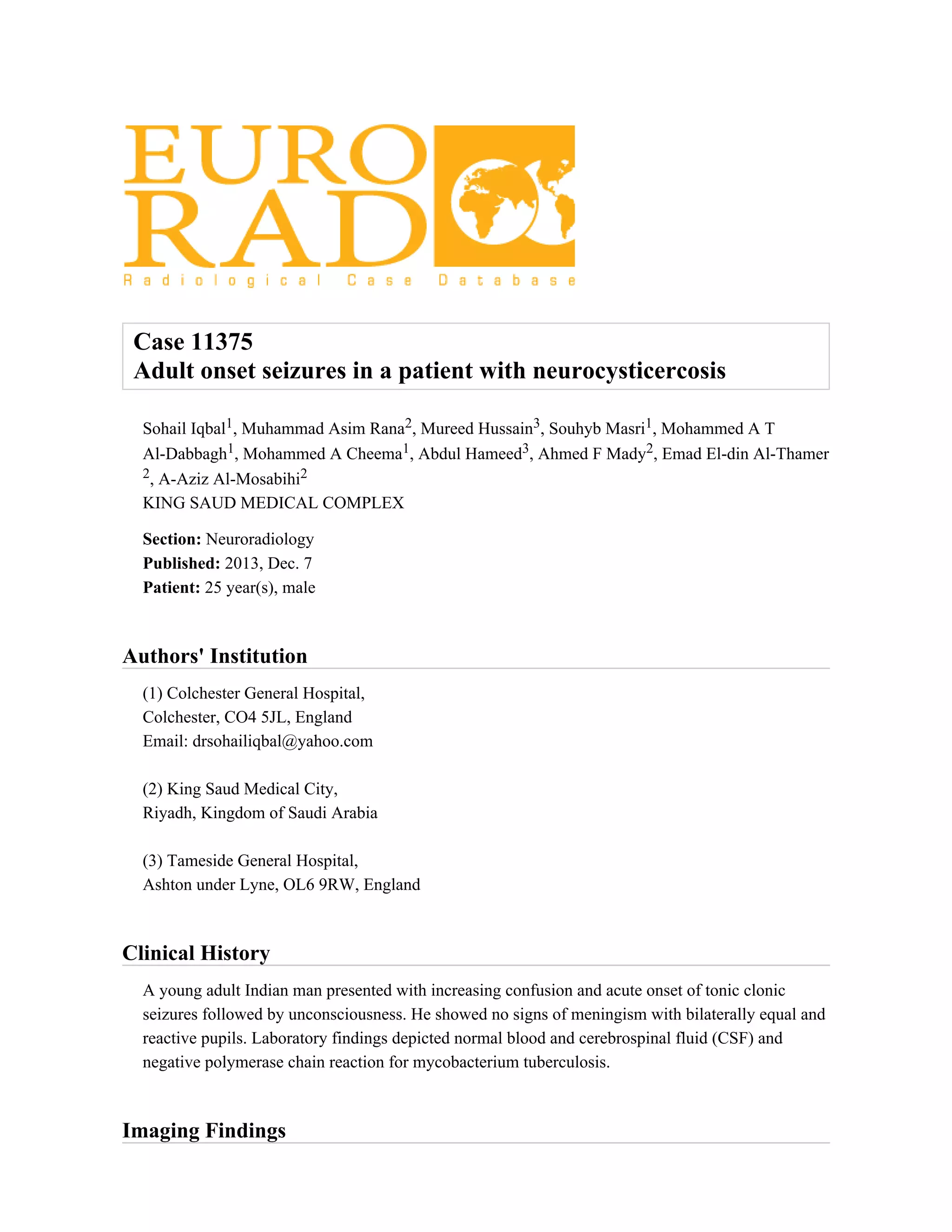 Adult onset seizures A case report | PDF
