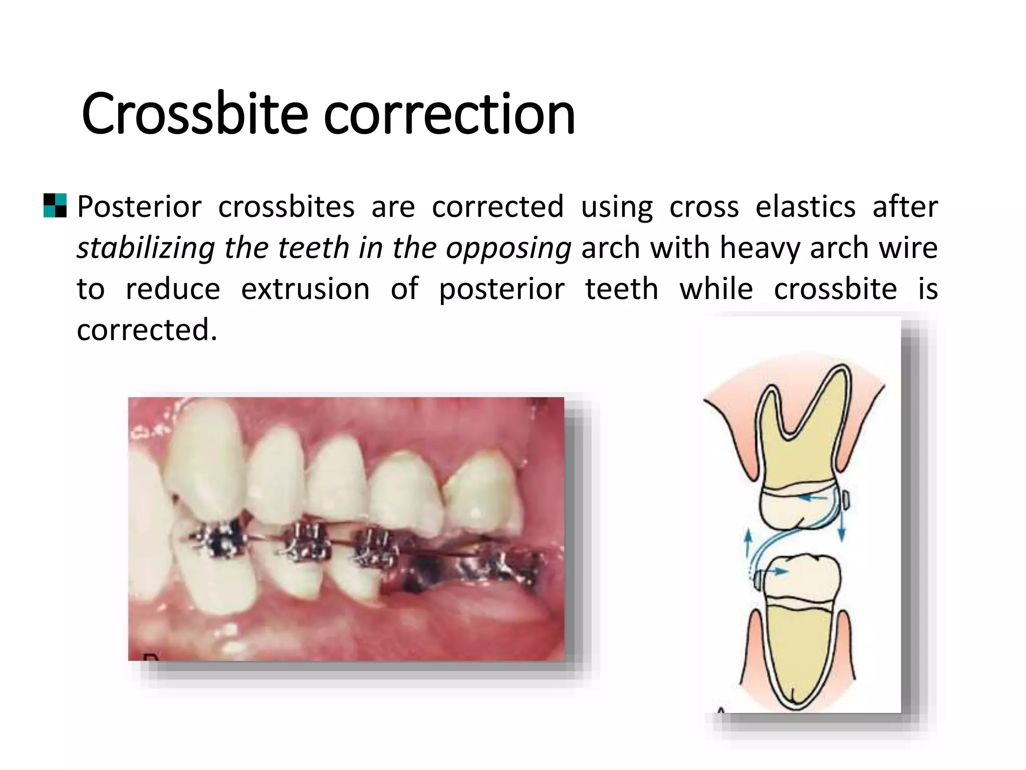Adult Orthodontics.pptx