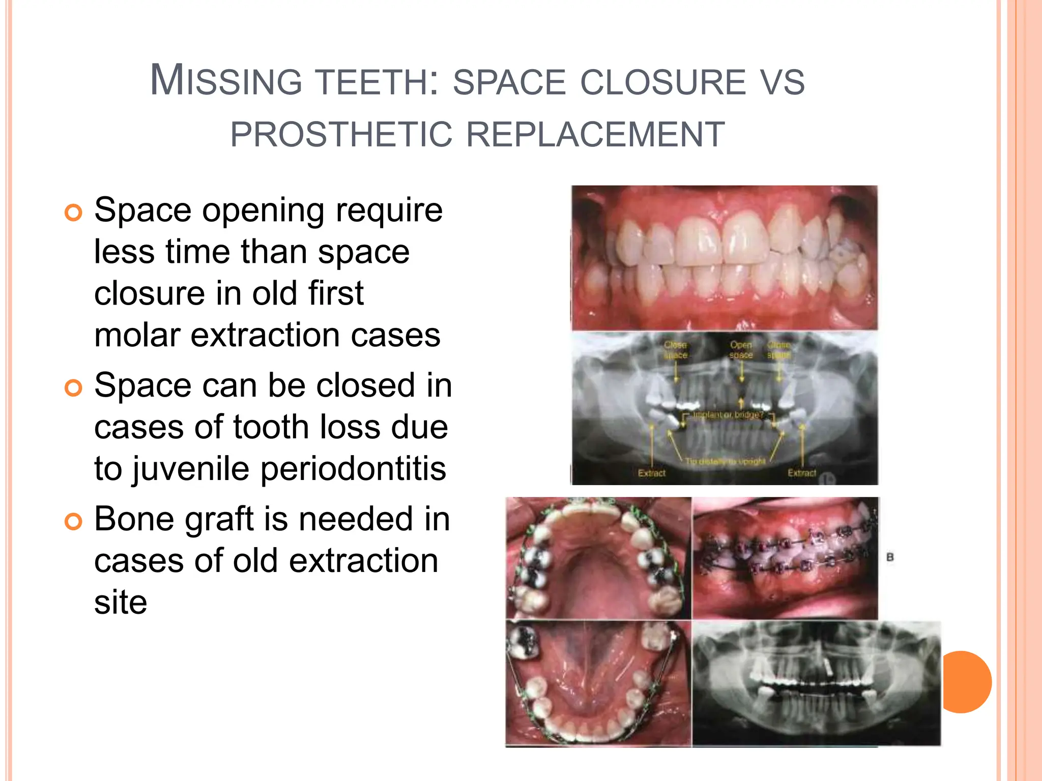 adult orthodontics.pptx by contemporary orthodontics | PPTX
