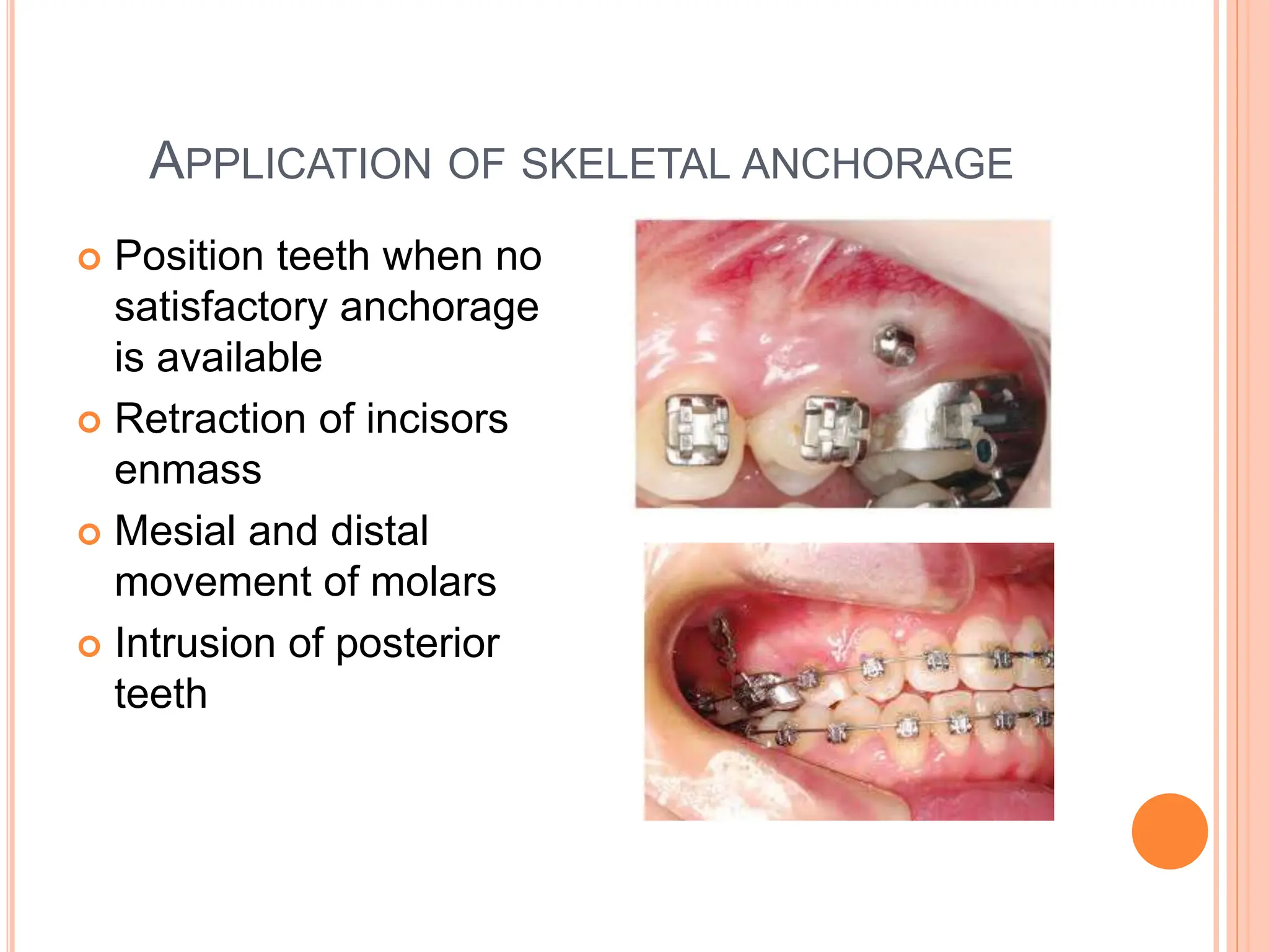 adult orthodontics.pptx by contemporary orthodontics | PPTX