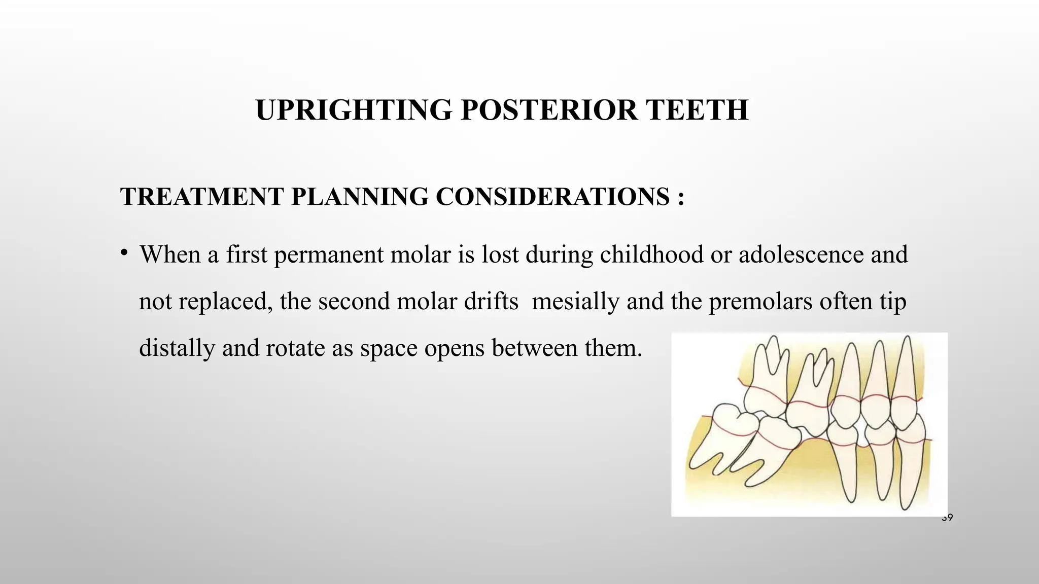 orthodontics seminar ADULT ORTHODONTICS .pptx