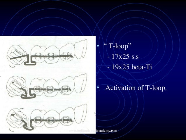 Adult orthodontics 2