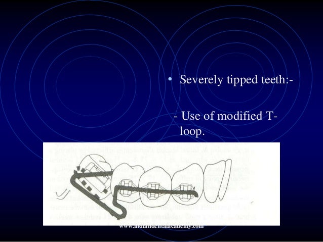 Adult orthodontics 2