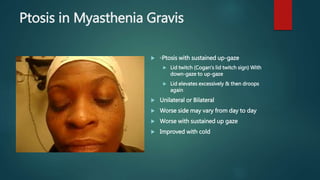 Adult ptosis | PPT