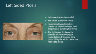 Adult ptosis | PPT