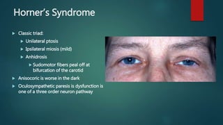 Adult ptosis | PPT