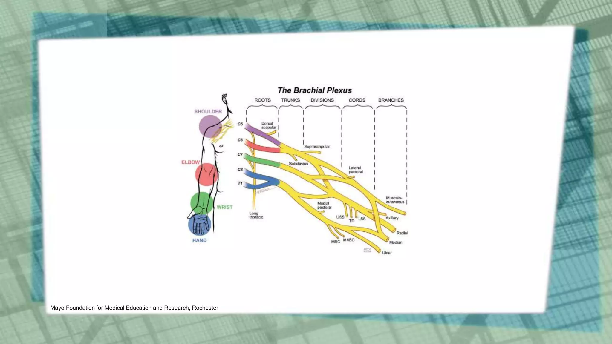 Adult Traumatic Brachial Plexus Injury | PPTX