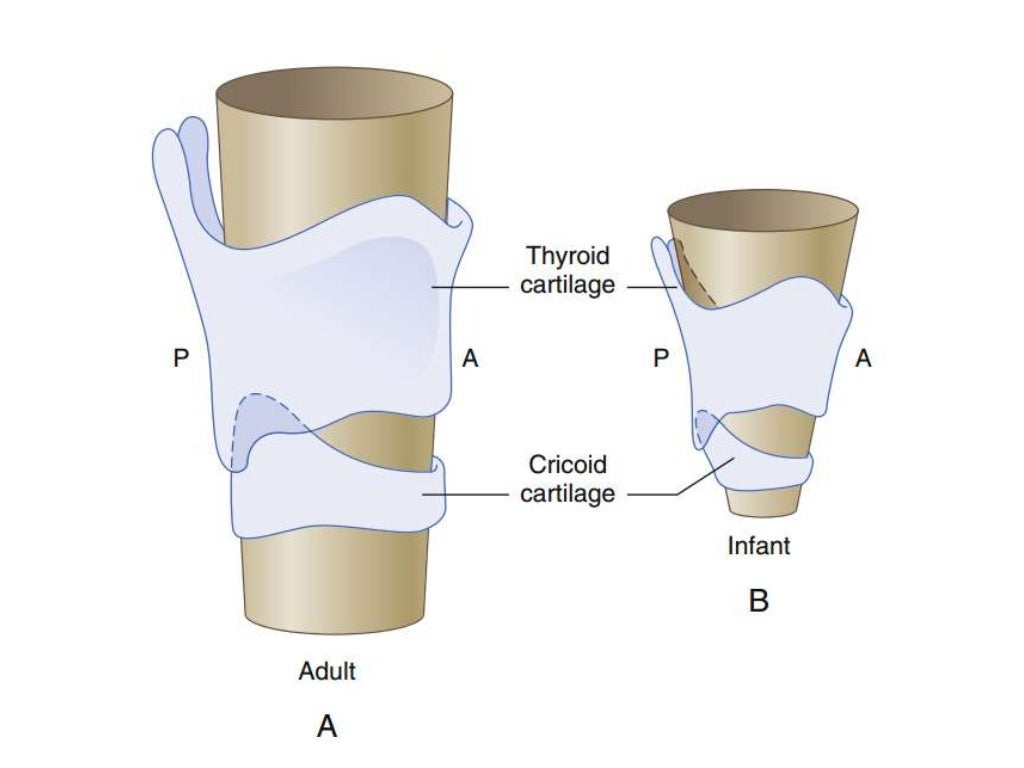 Adult vs. pediatric larynx, laryngeal nerve palsies and management | PPTX