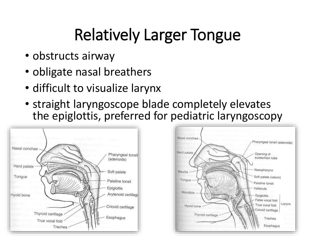 Adult vs. pediatric larynx, laryngeal nerve palsies and management | PPTX