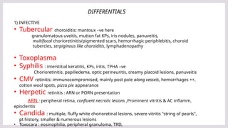 A Case report of Toxoplasma Retinochoroiditis | PPT