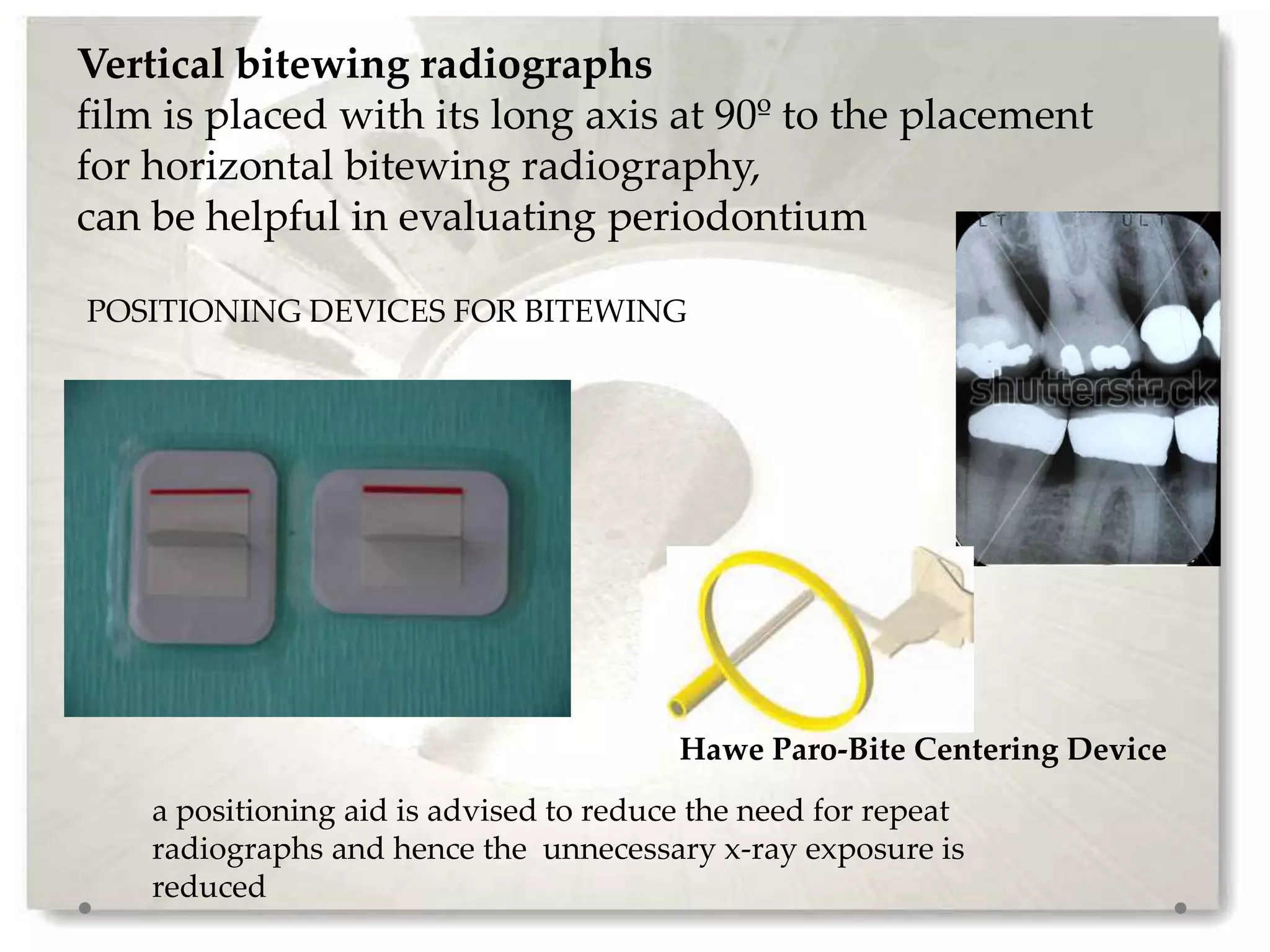 Advanced radiographic aids in periodontics | PPTX