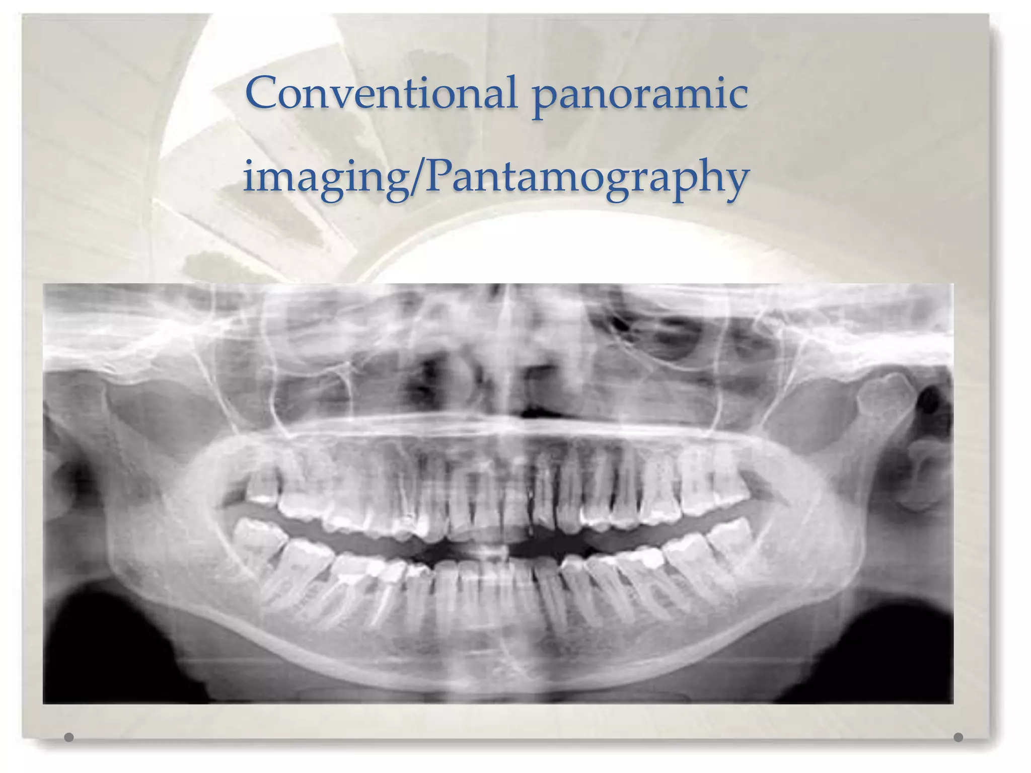 Advanced radiographic aids in periodontics | PPTX
