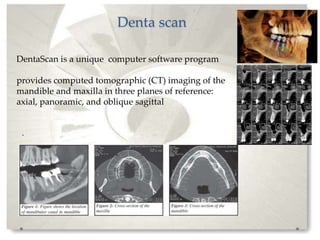 Advanced radiographic aids in periodontics | PPTX